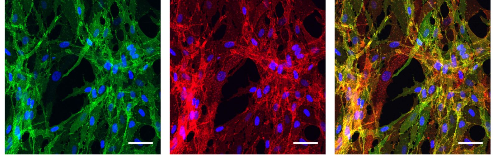 Program for Advanced Cell Therapy – Integrated personalized cell ...