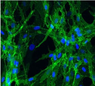 Program for Advanced Cell Therapy – Integrated personalized cell ...