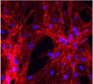 Program for Advanced Cell Therapy – Integrated personalized cell ...