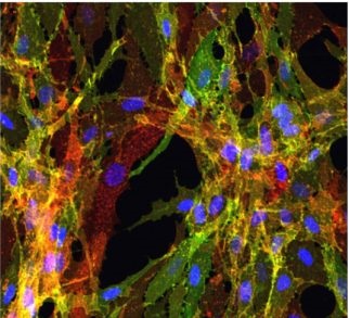 Program for Advanced Cell Therapy – Integrated personalized cell ...